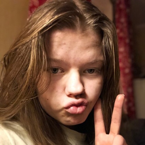 @lolisosa_a • Tise